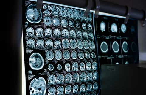 STAT画像報告ができるようになろう！ MRI編 ＜放射線診断専門医が解説！＞ ドクターネットエージェント