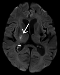 STAT画像報告ができるようになろう！ MRI編 ＜放射線診断専門医が解説！＞ ドクターネットエージェント
