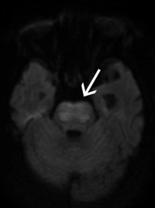 STAT画像報告ができるようになろう！ MRI編 ＜放射線診断専門医が解説！＞ ドクターネットエージェント