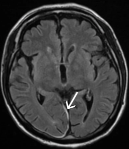 STAT画像報告ができるようになろう！ MRI編 ＜放射線診断専門医が解説！＞ ドクターネットエージェント